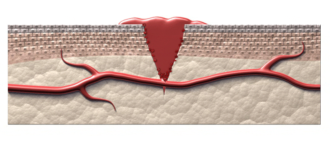 How White Blood Cells Fight Germs | Kids Discover Online